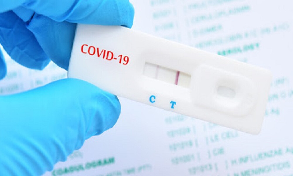 ΤΑ ΣΗΜΕΙΑ ΓΙΑ ΔΩΡΕΑΝ RAPID TEST -COVID-19 ΓΙΑ ΣΗΜΕΡΑ | ArtaVoice - Τα ...